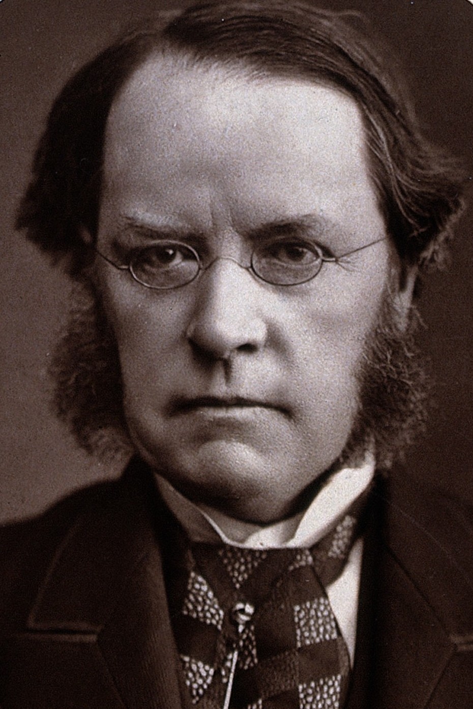 Simpson’s Great Discovery | From the Inside Out